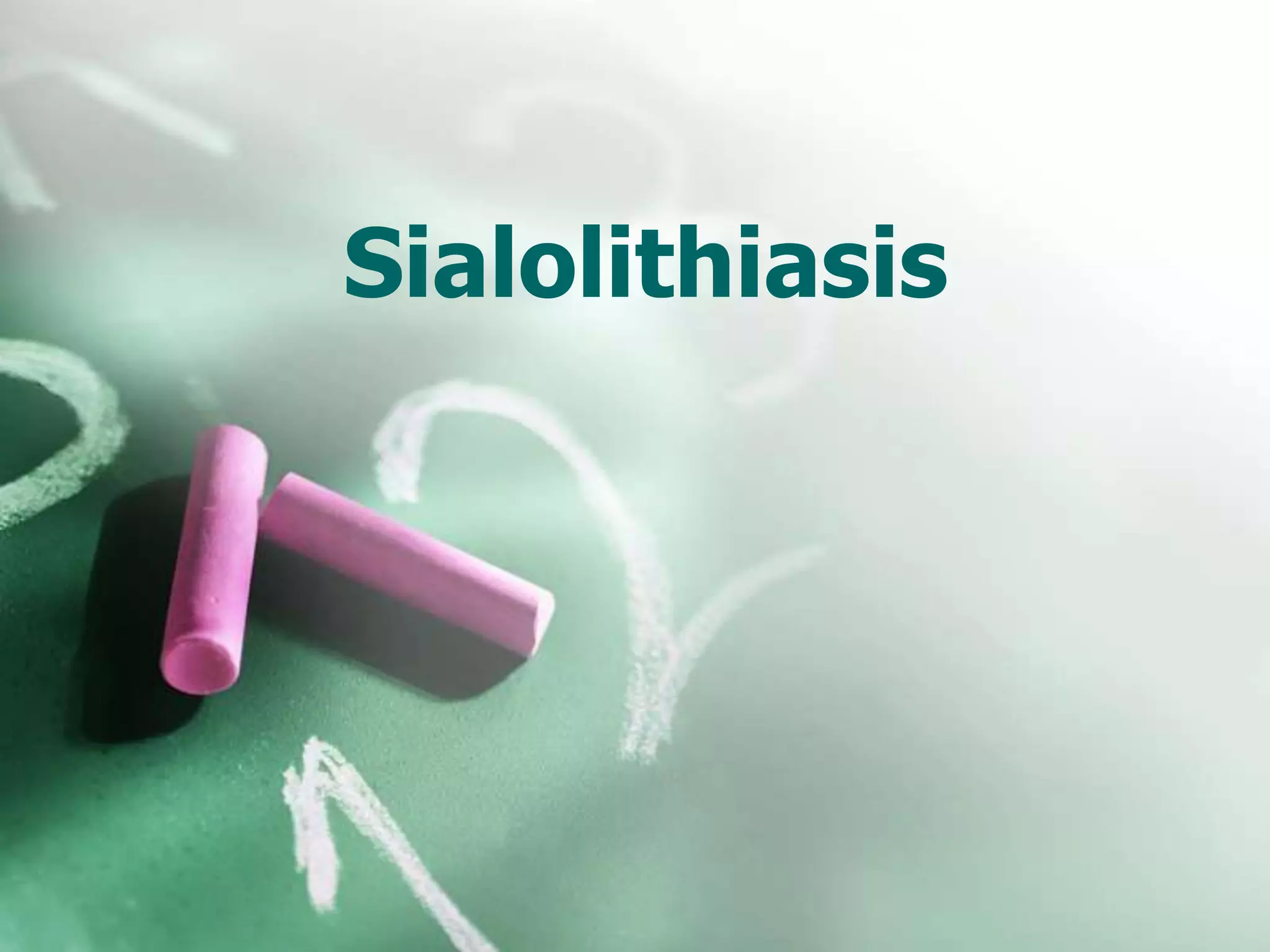 Sialolithiasis | PPTX