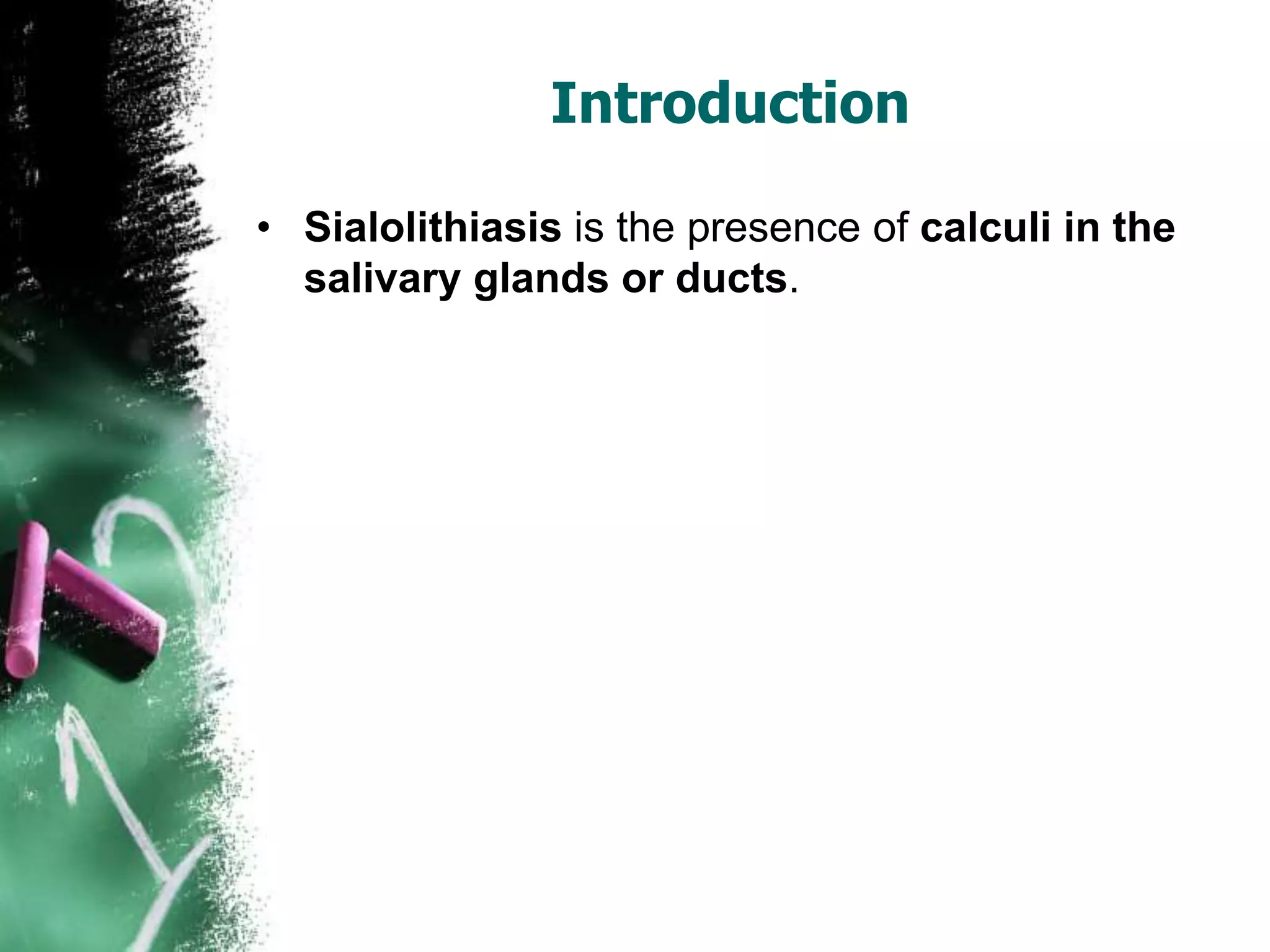 Sialolithiasis | PPTX