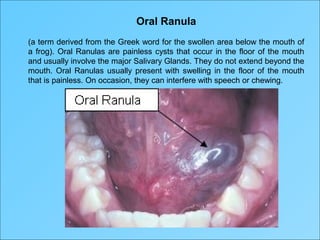 Salivary surgery | PPT