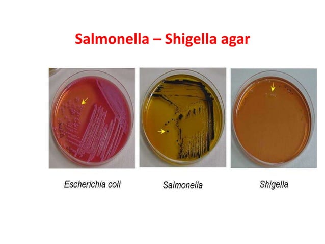 Salmonella.ppt salmonella classification and it's diseases | PPT