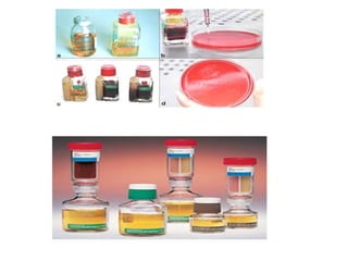 Salmonella typhi bacteria with all details | PPTX