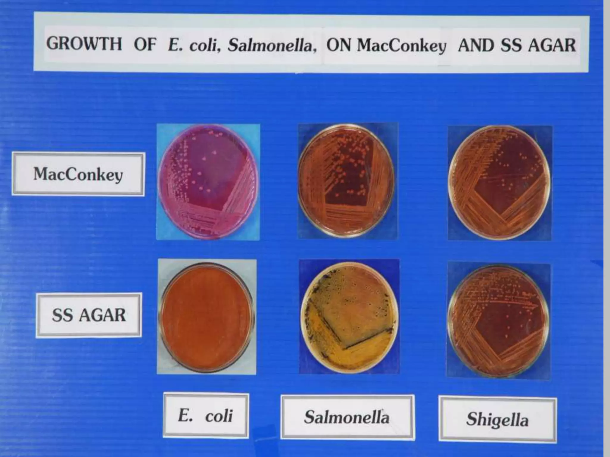 Salmonella shigella & yersinia dr.ihsan alsaimary | PPTX