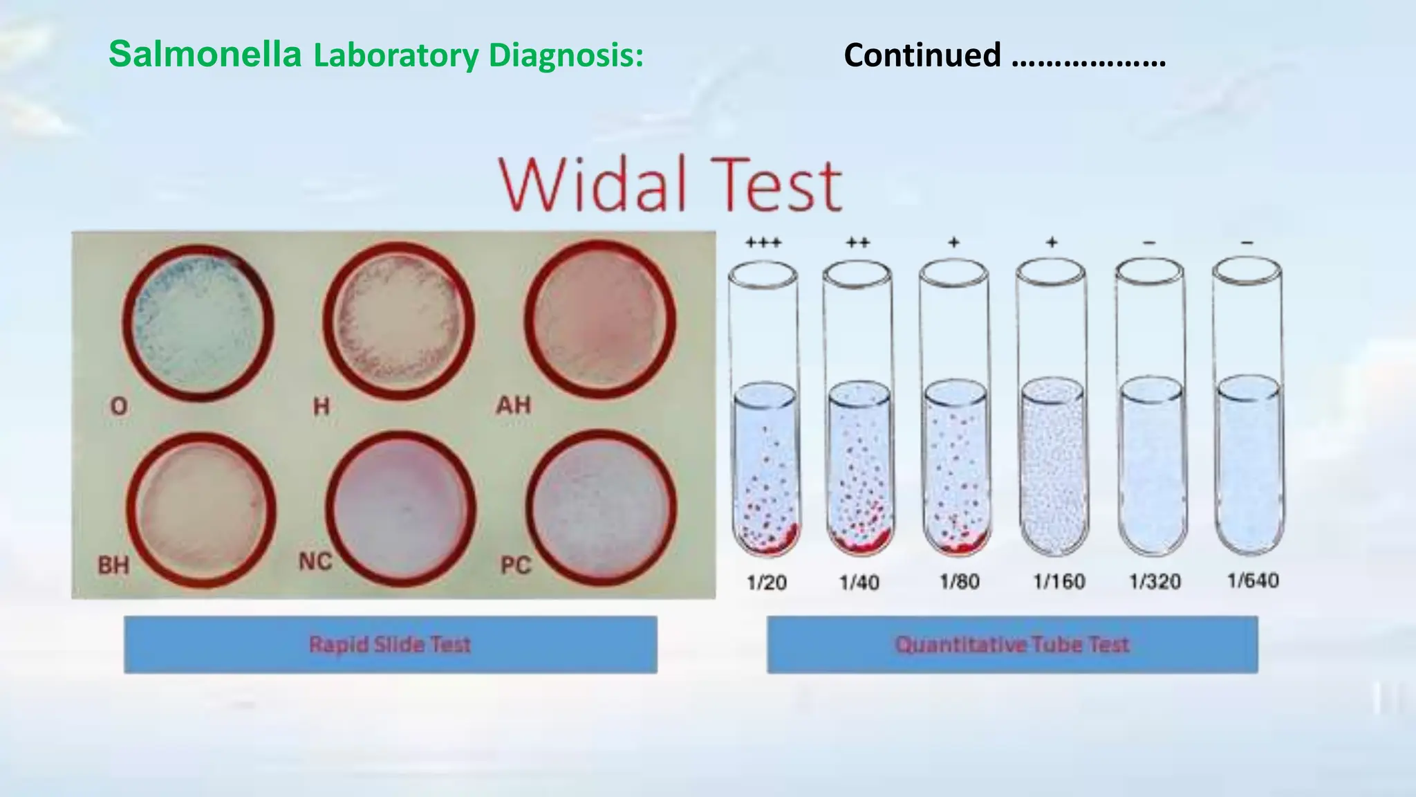 Microbiology- Bacteriology - Salmonella, Shigella & Proteus | PPTX