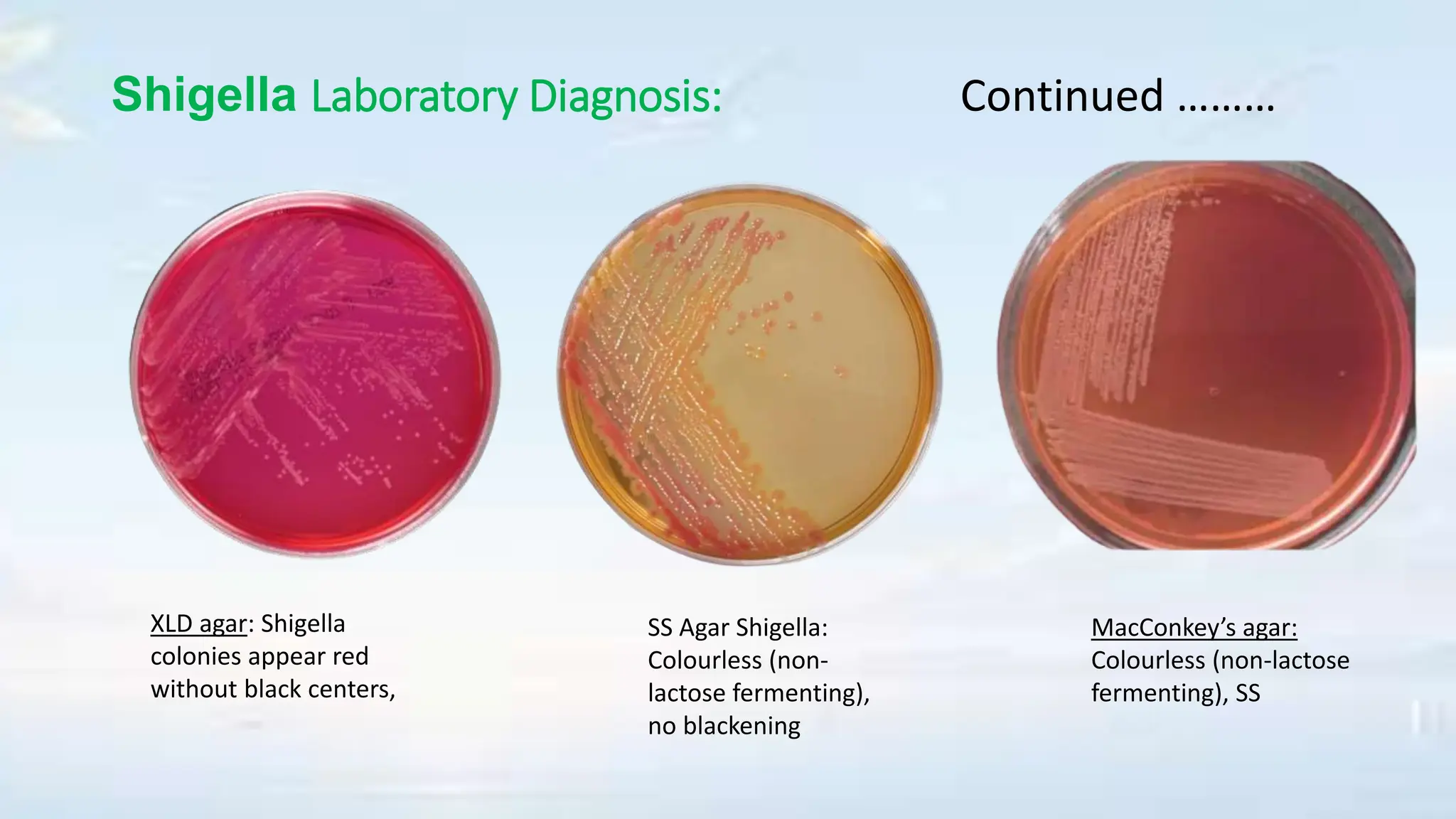 Microbiology- Bacteriology - Salmonella, Shigella & Proteus | PPTX