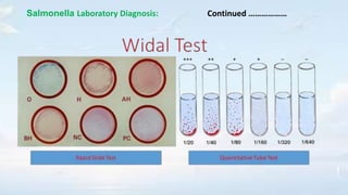 Microbiology- Bacteriology - Salmonella, Shigella & Proteus | PPTX