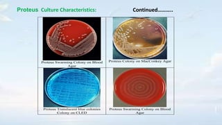 Microbiology- Bacteriology - Salmonella, Shigella & Proteus | PPTX