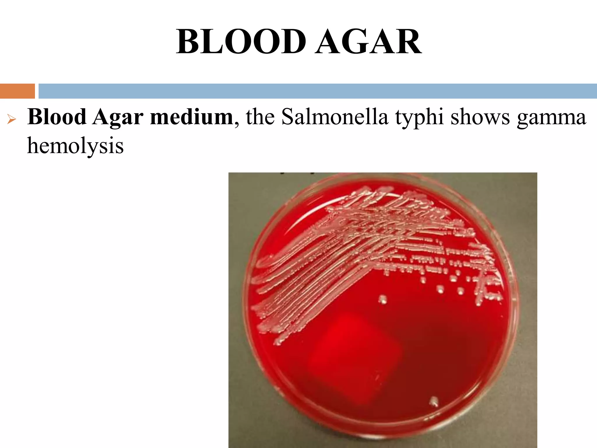 Salmonella typhi | PPTX