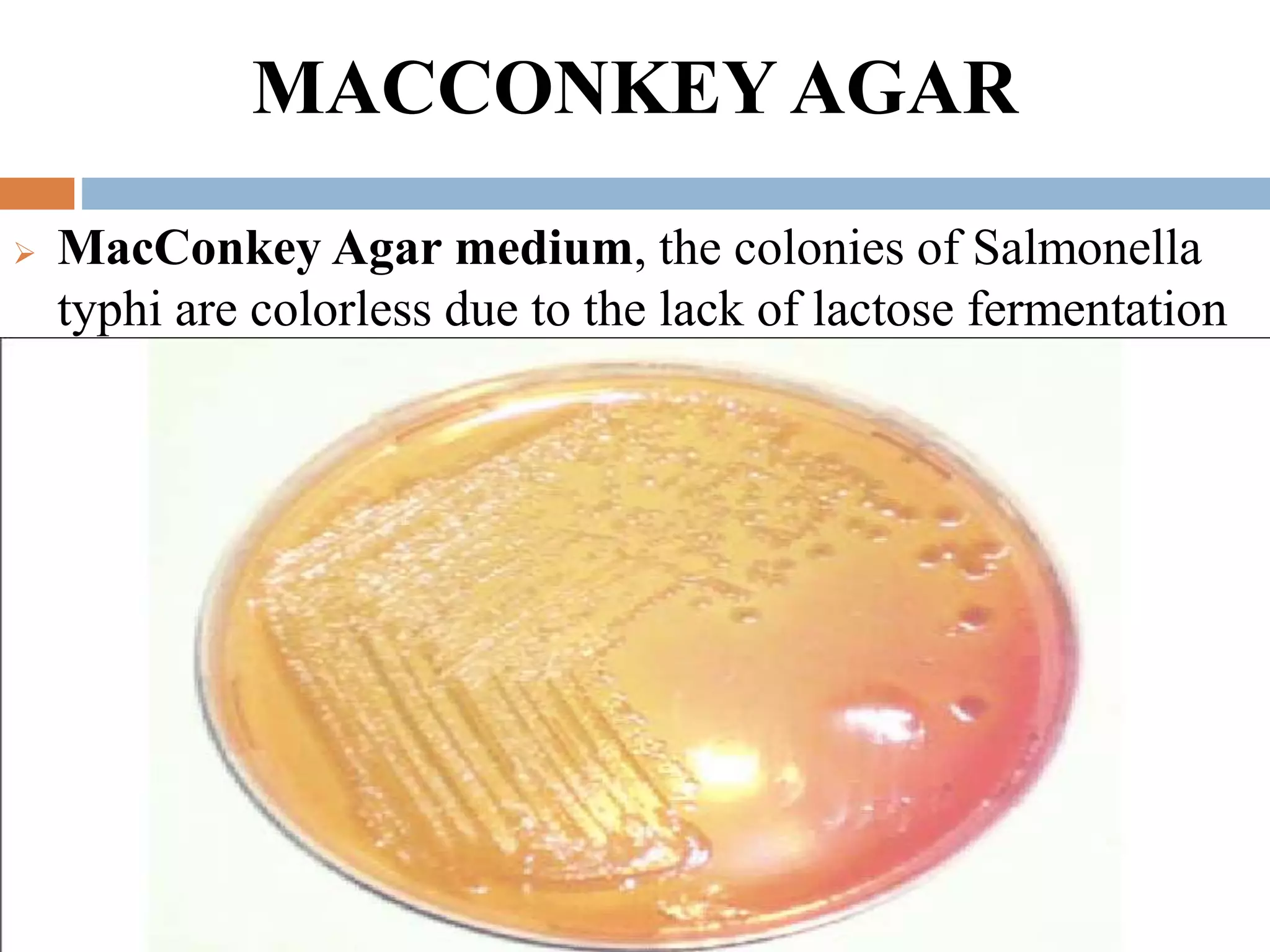 Salmonella typhi | PPTX