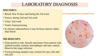 Salmonella typhi-Typhoid fever | PPTX
