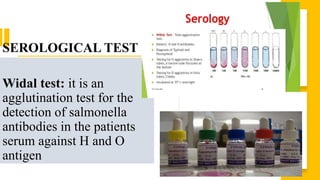Salmonella typhi-Typhoid fever | PPTX