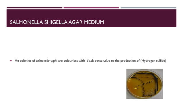 Salmonella typi - Morphology, culture characteristics, laboratory ...