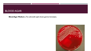 Salmonella typi - Morphology, culture characteristics, laboratory ...