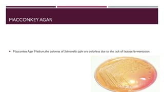 Salmonella typi - Morphology, culture characteristics, laboratory ...