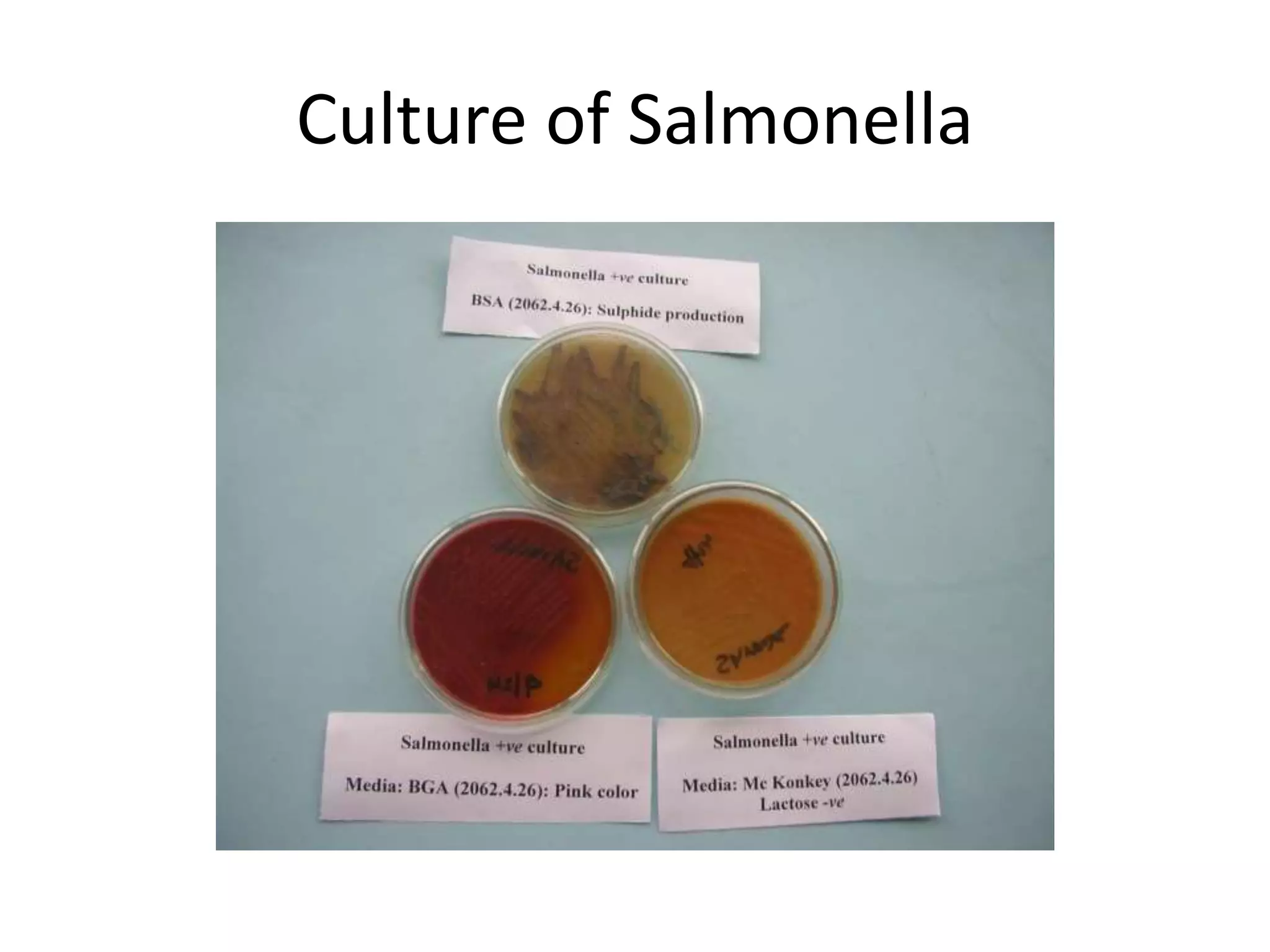 Salmonellosis | PPTX