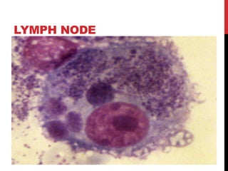 Salmon poisoning | PPT