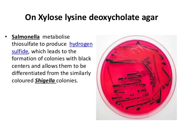 Xylose Lysine Deoxycholate Xld Agar Principle Uses