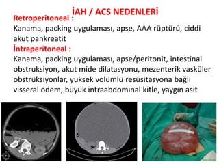 Salon a 14 kasim 10.15 11.00 tahi̇r özer | PPTX