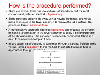 Salpingectomy for ovarian risk reduction | PPTX