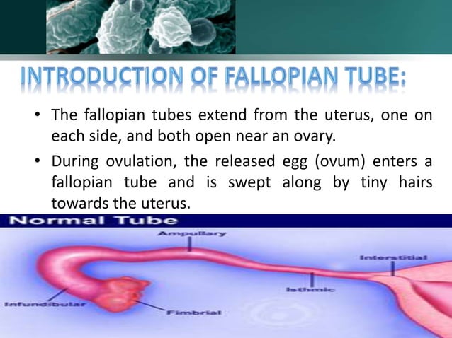 Salpingitis | PPTX | Infertility | Reproductive Health