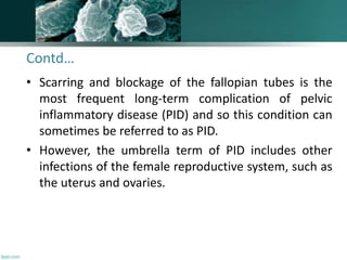 Salpingitis | PPTX