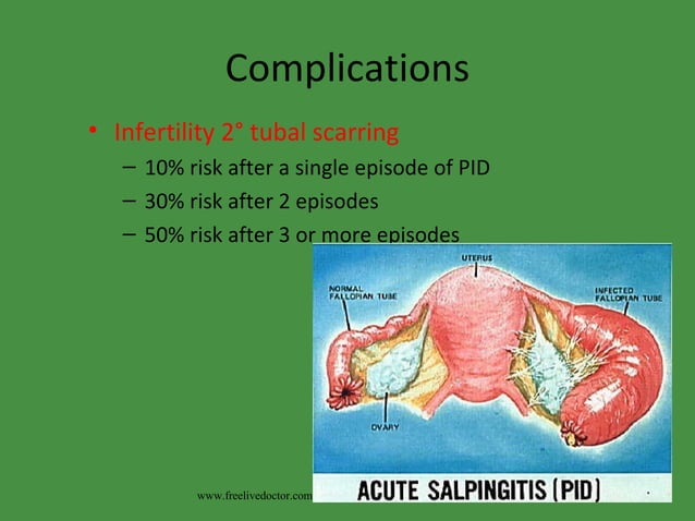 Salpingitis and related diseases | PPT | Reproductive Health | Diseases ...