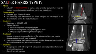 Salter-Harris-II-Tibial-Fracture-Kyra-Frost-MS4-Dr.M.-Kumaravel-Copy-1.pdf