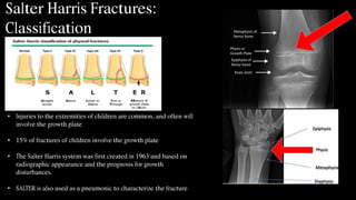 Salter-Harris-II-Tibial-Fracture-Kyra-Frost-MS4-Dr.M.-Kumaravel-Copy-1.pdf