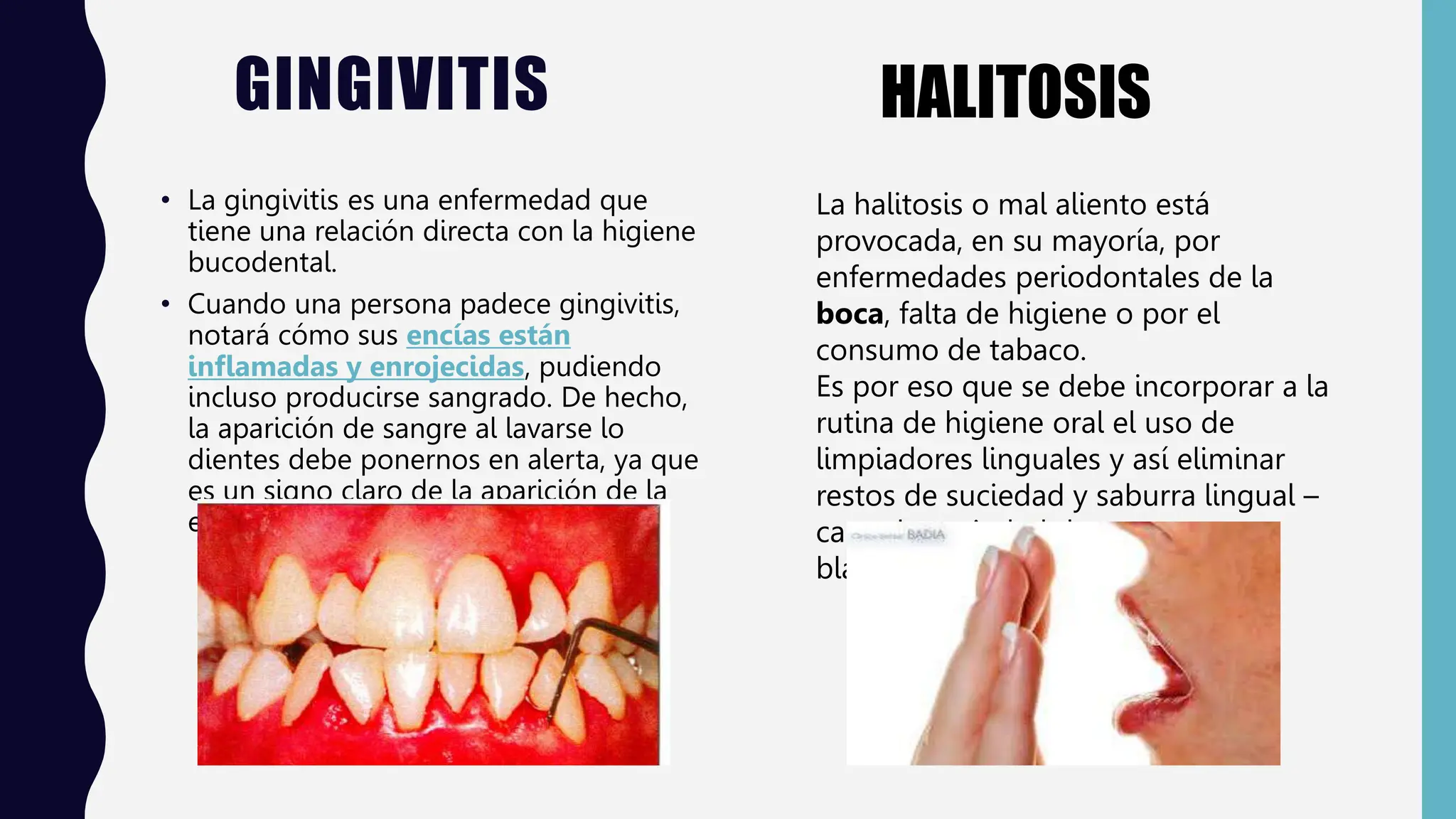 SALUD BUCAL EXPOSICION DETALLADA OK .pptx