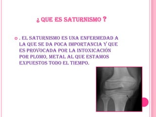 Salud ocupacional ronald | PPTX