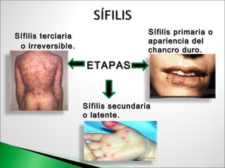 SALUD SEXUAL Y ENFERMEDADES DE TRANSMISION SEXUAL | PPT