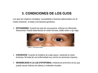 Salud visual (cuida tus ojos) | PPTX