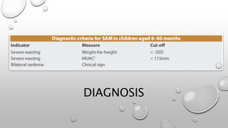 Severe Acute Malnutrition | PPTX