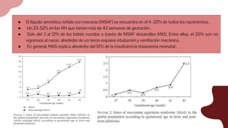 Sindrome de aspiracion meconial | PPTX