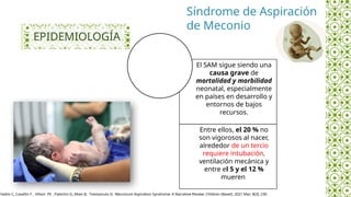 Sindrome de Aspiracion de Meconio en Neonatologia.pptx