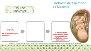 Sindrome de Aspiracion de Meconio en Neonatologia.pptx