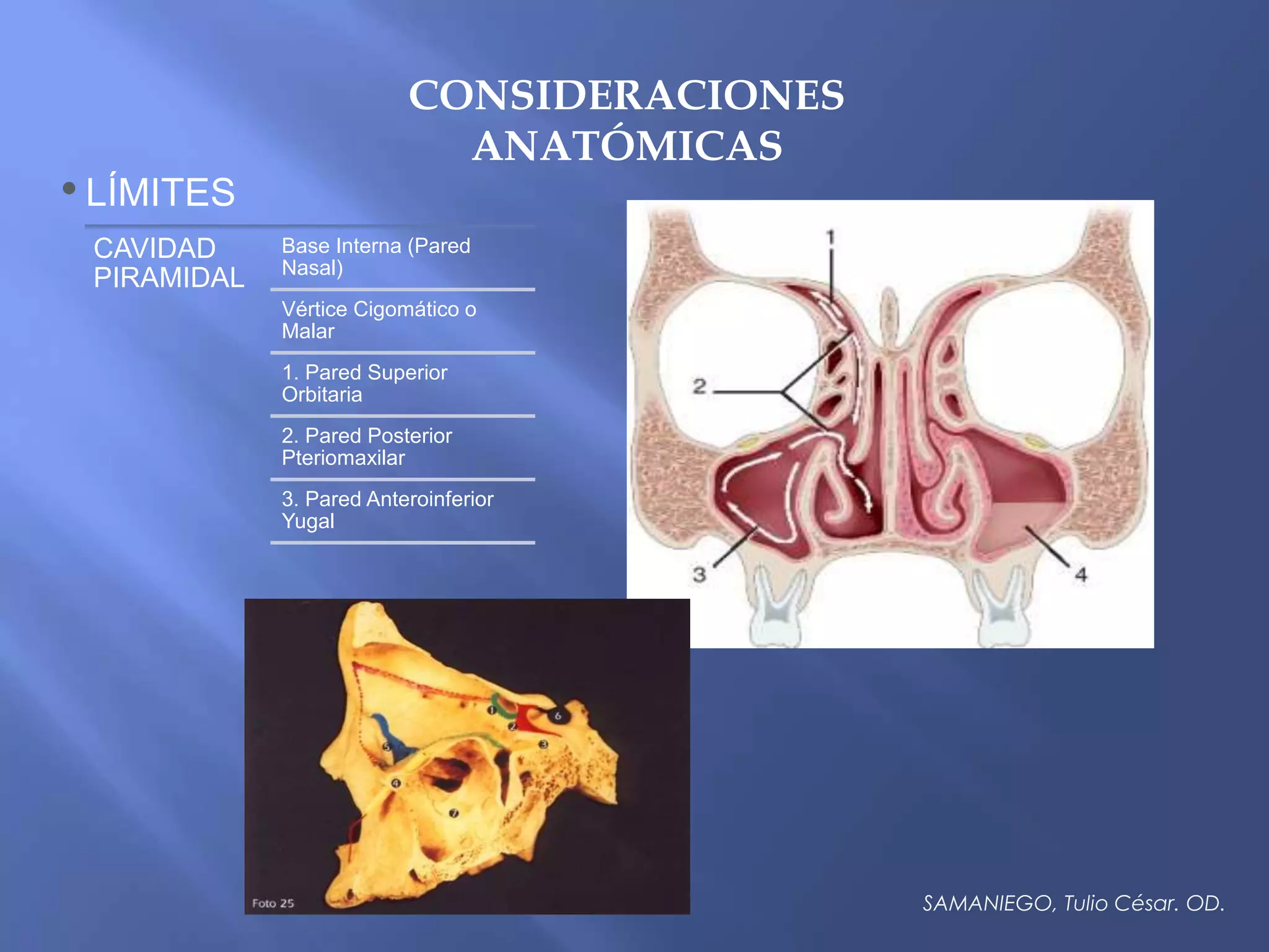 ELEVACIÓN DE PISO DE SENO MAXILAR: Consideraciones Anatómicas y ...