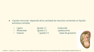 Síndrome. De aspiración. De meconio.pptx