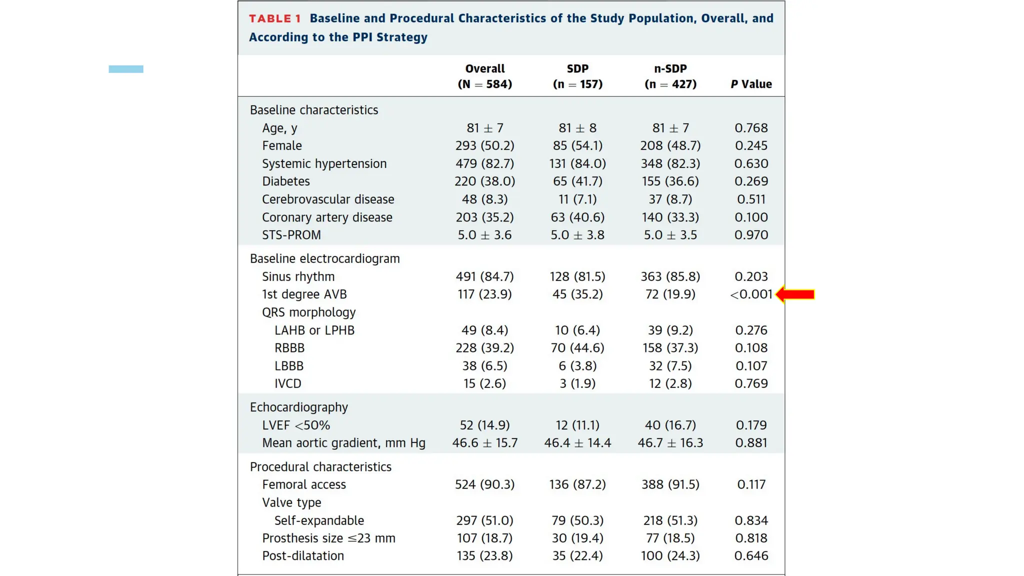 Same-Day Permanent Pacemaker Implantation Following Transcatheter ...