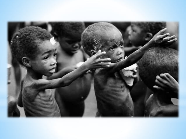 Severe Acute Malnutrition