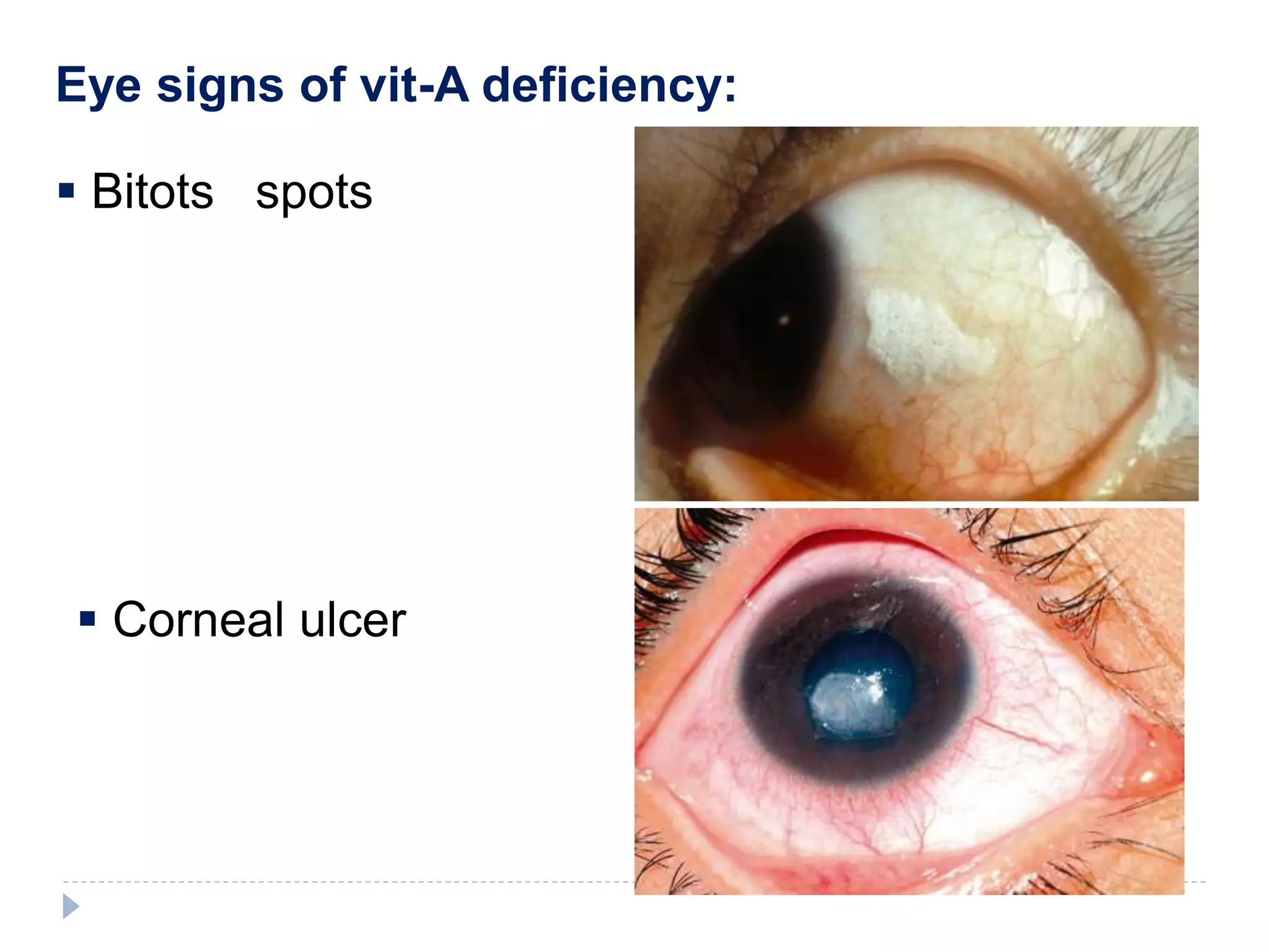seminar on SAM | PPTX
