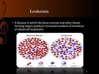 LEUKEMIA | PPT