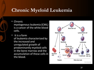 Leukemia Cells Diagram