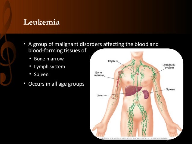 LEUKEMIA
