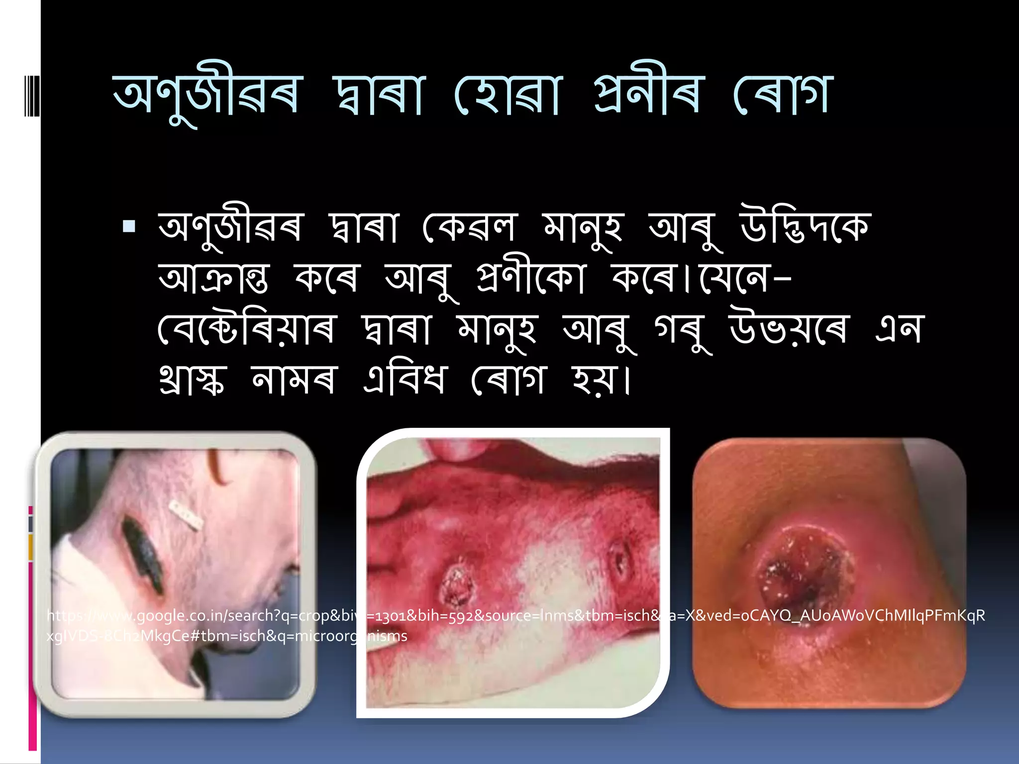 Samima sultana | PPTX