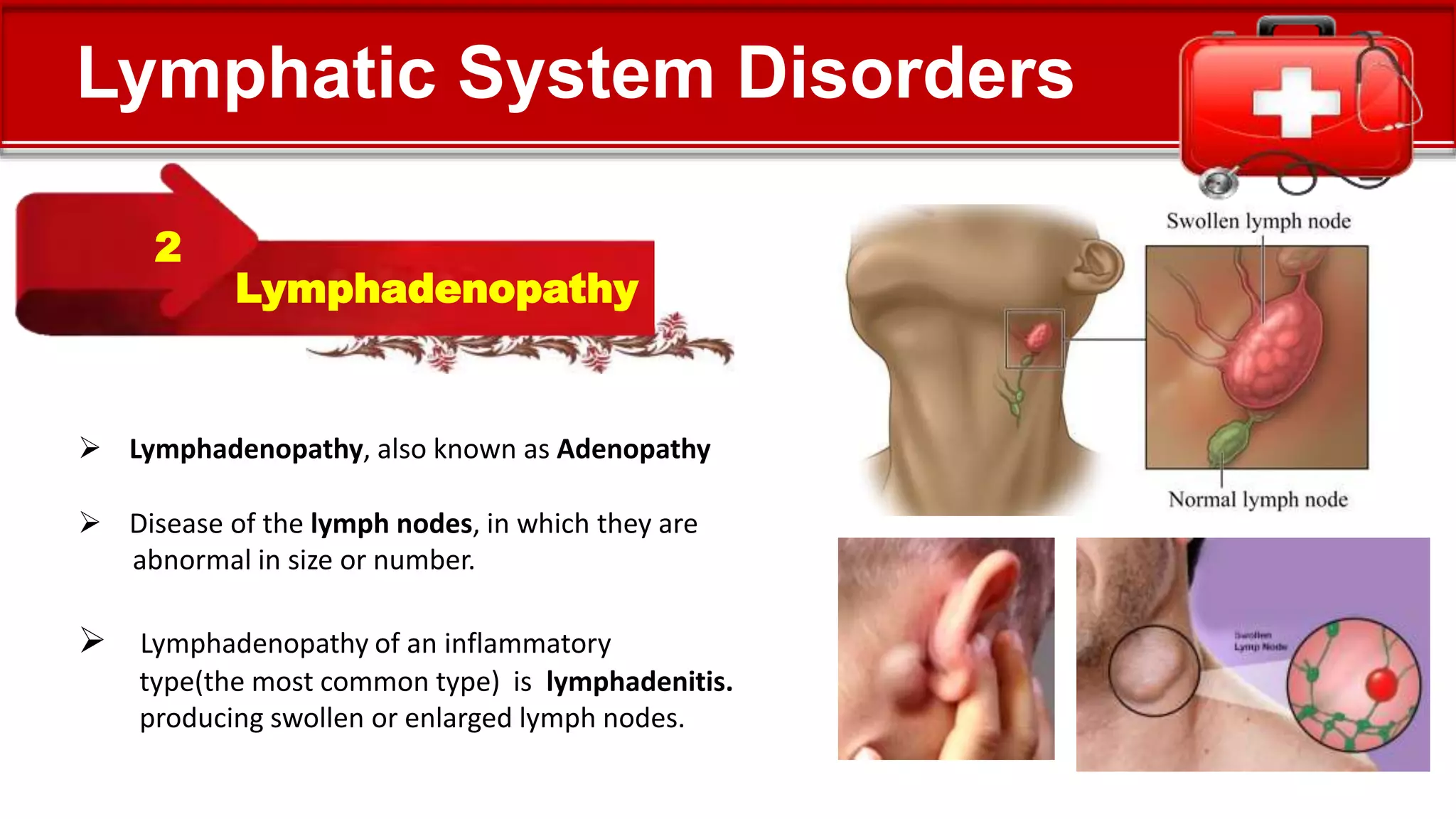 Lymphatic System Disorders | PPSX