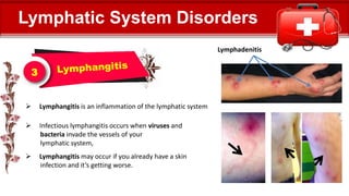 Lymphatic System Disorders | PPSX
