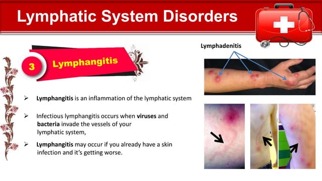 Lymphatic System Disorders