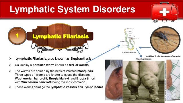 Lymphatic System Disorders