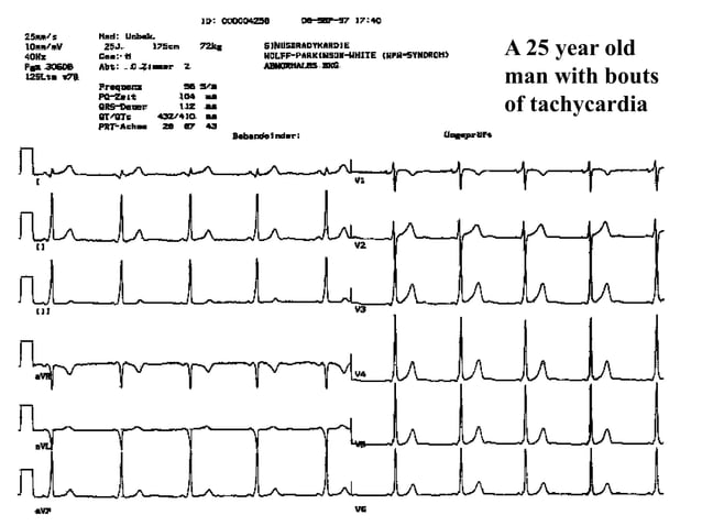 Samir rafla ecg arrhythmia for medical students- added amr kamal | PPT