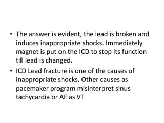 Samir rafla ecg quiz from saudi arabia cardiology conference 2013 | PPT